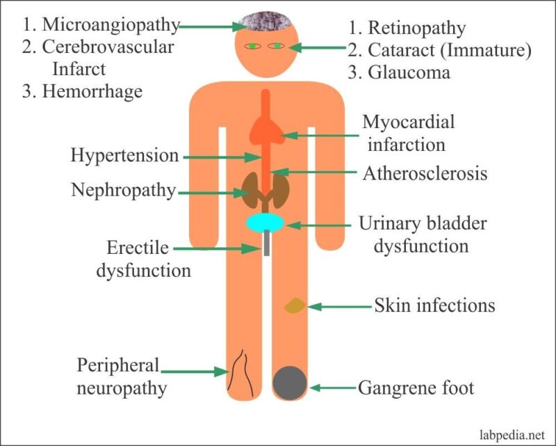 How To Tell if You Are Diabetic: Early signs, symptoms, treatment | Dr ...